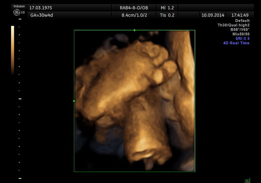 USG 3D SZCZECIN USG 4D CENA 250 PLN - SZCZECIN PŁYTA FILM DVD +ZDJĘCIA ...