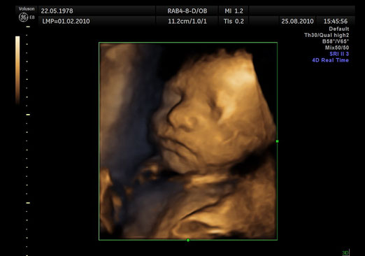 USG 3D SZCZECIN USG 4D CENA 250 PLN - SZCZECIN PŁYTA FILM DVD +ZDJĘCIA ...