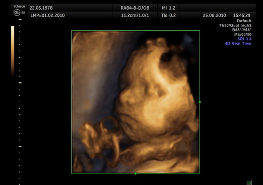 USG 3D SZCZECIN USG 4D CENA 250 PLN - SZCZECIN PŁYTA FILM DVD +ZDJĘCIA ...