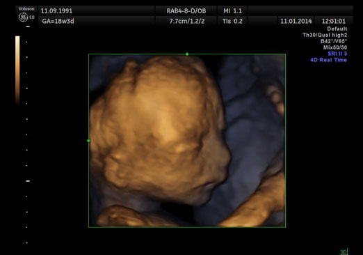 USG 3D SZCZECIN USG 4D CENA 250 PLN - SZCZECIN PŁYTA FILM DVD +ZDJĘCIA ...