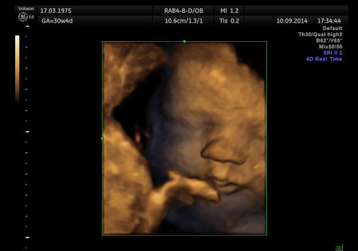 USG 3D SZCZECIN USG 4D CENA 250 PLN - SZCZECIN PŁYTA FILM DVD +ZDJĘCIA ...