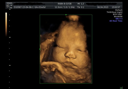 USG 3D USG 4D CENA 250 PLN - SZCZECIN PŁYTA FILM DVD +ZDJĘCIA Z ...