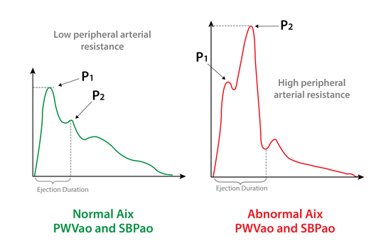 Arteriograph Company - Pulse Wave Analysis & Arterial Stiffness