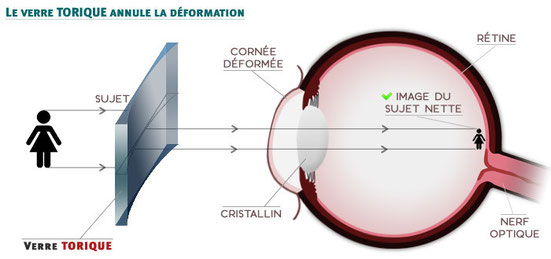 Partie I : de l'oeil au cerveau : quelques aspects de la vision - Site ...