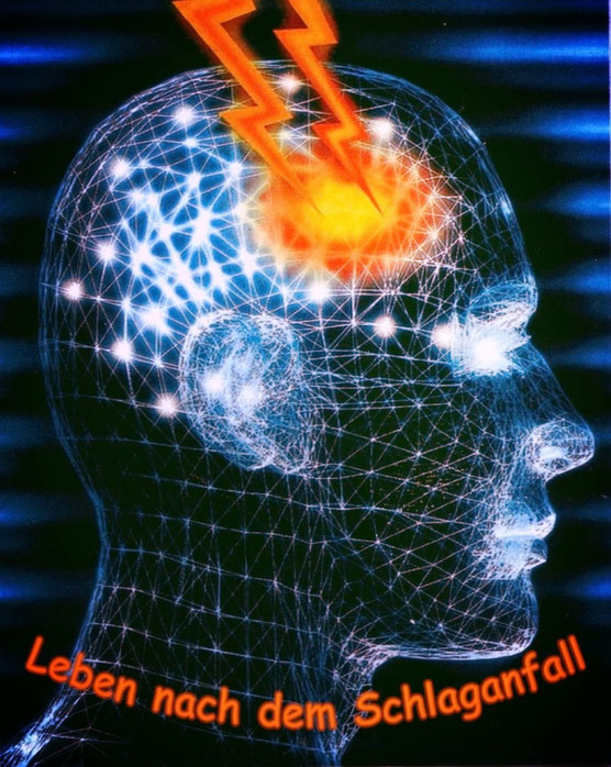 Der Hirninfarkt - nachdemschlaganfalls Webseite!