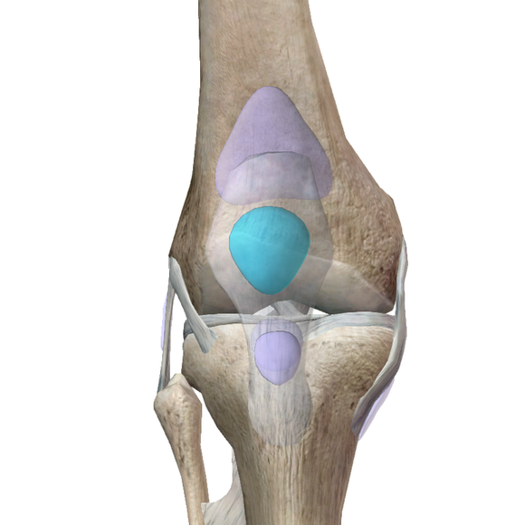 Hygroma du genou - PRO-TMS