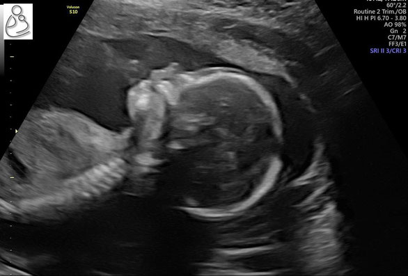 Pränataldiagnostik - Frauenarztpraxis Dr. med. Oettle & Kolleginnen