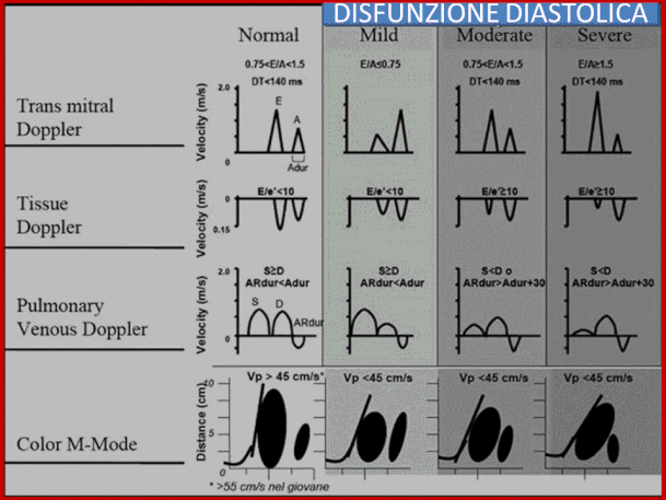 *Insufficienza cardiaca con funzione sistolica conservata - gennarino ...