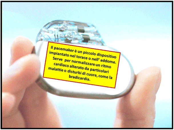 °Quando la frequenza cardiaca è