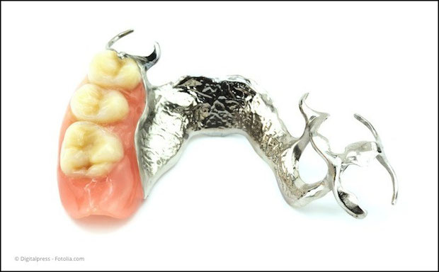 Zahnprothesen: Die Dritten - Zahnarzt Frankfurt Zentrum