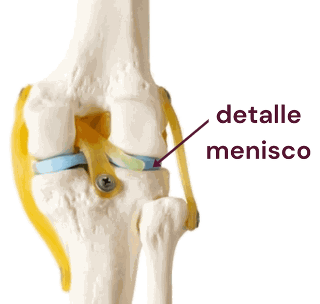 REHABILITACIÓN MENISCO CON FISIOTERAPIA - ️ San Javier Fisioterapia