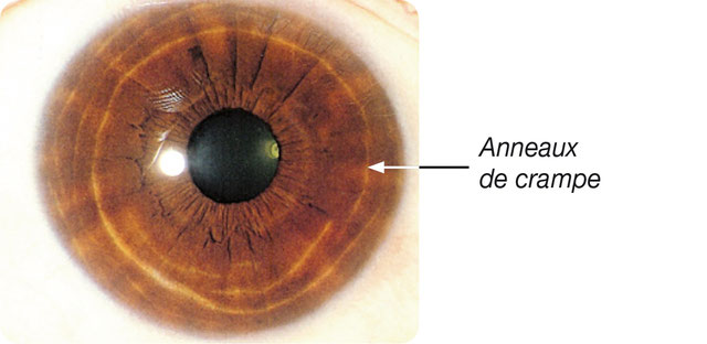 L'IRIDOLOGIE - naturopathie-saint-nazaire.fr