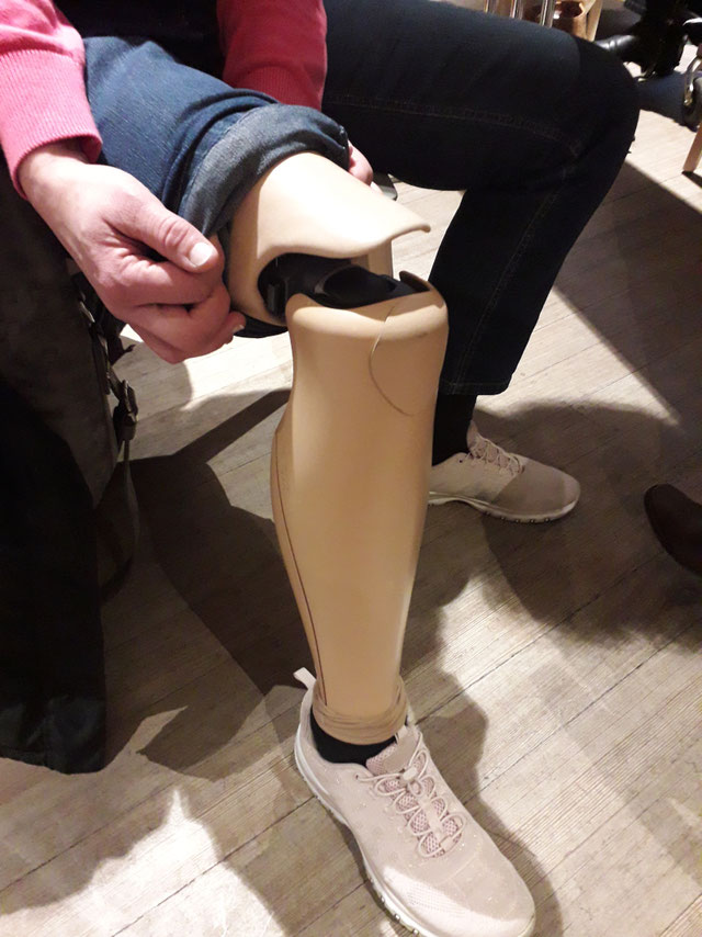 Blog - beinamputiert - was - geht - Selbsthilfe