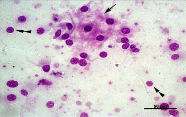 Retrospective Study of 33 Dogs Diagnosed with Osteosarcoma (OSA) by ...