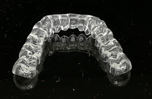 Knirscherschienen - Dentaltechnik Ostertag