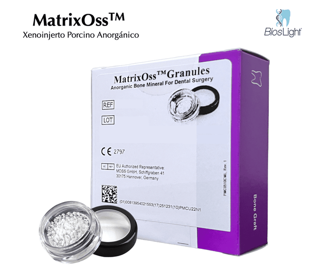 Biomateriales Dentales: Innovación en la Odontología Moderna - Bios Light