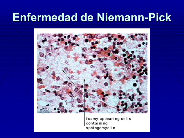 CLAVES PARA ENTENDER LA ENFERMEDAD DE PICK.(DEMENCIA) - ESTIMULACIÓN ...