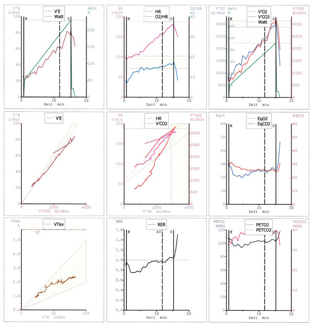 Spiroergometrie - Praxis Dr. Wylicil - Innere Medizin, Pneumologie