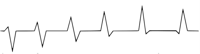 Achsenrotation - Fokus-EKG