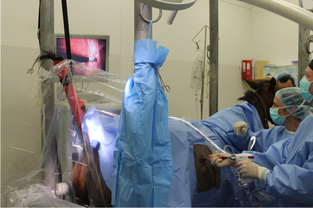 Laparoscopy - Dr Nick Kannegieter and Dr Hadley Willsallen Specialist ...