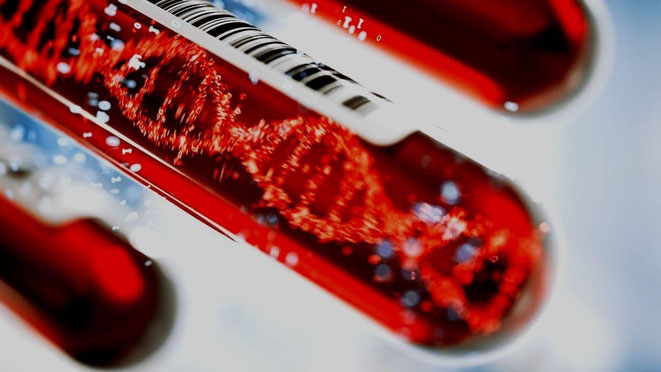 GRAIL Galleri® liquid biopsy cancer detection test - Epigenetic market ...