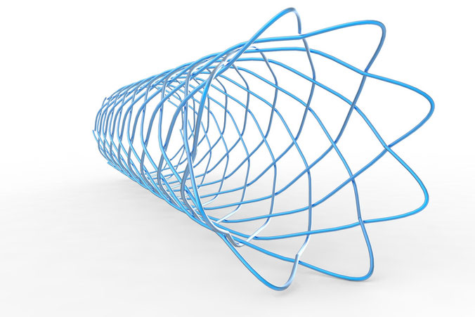 Stent Design & FEA - FEA/FEM-WORKS