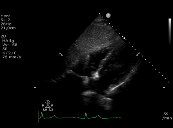 Anästhesiefokussierte Sonografie - Löffler Notfallmedizin - Medical ...