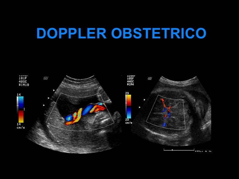 Uso del Doppler en obstetricia - Nasajpg.com