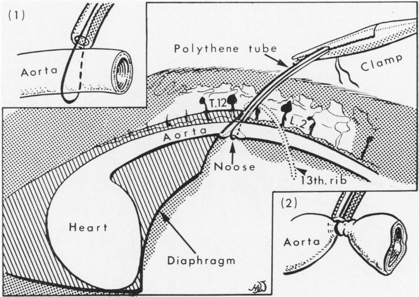 The Treatment of Malignant Tumours of Bone in the Dog by Intra-Arterial ...