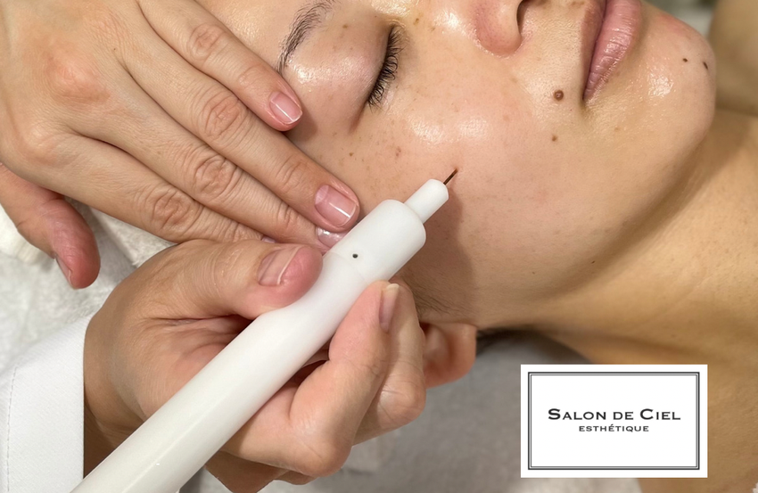 Pigmentation Detox Ⅱ シミデトックス - Salon de Ciel Pigmentation Detox Ⅱ シミデトックス - Salon de Ciel