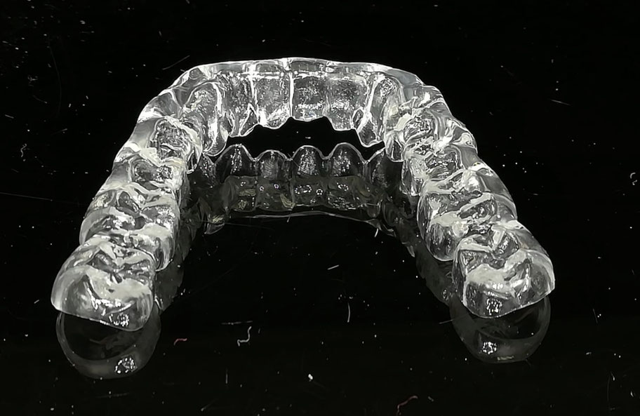 Knirscherschienen - Dentaltechnik Ostertag