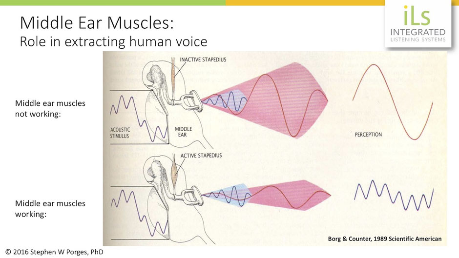 Hyperakusis I warum ist alles ist zu laut? - Privatpraxis Robert Kroll