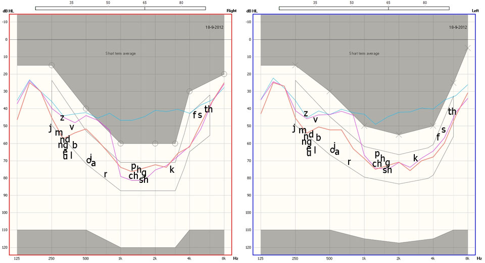 Visual Speech Mapping - De website van Kooijman Hoortoestellen!