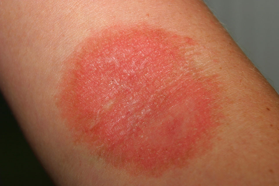 La teigne du chat - Consultations en Dermatologie Vétérinaire