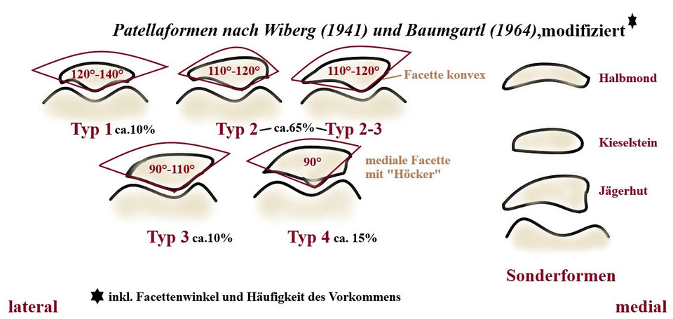 R1 Patellofemoral/FEW - see-feel-treats Webseite!