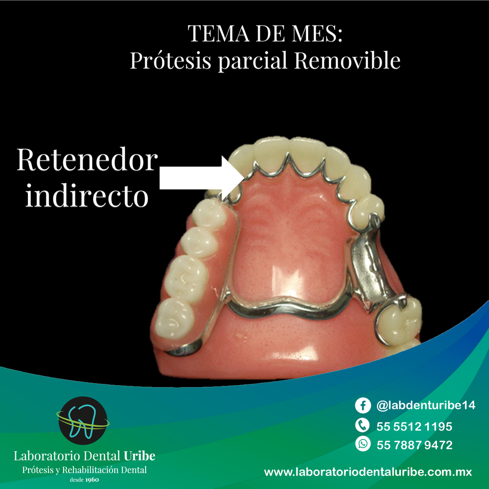 Tema del Mes: Prótesis Parcial Removible - Página web de ...