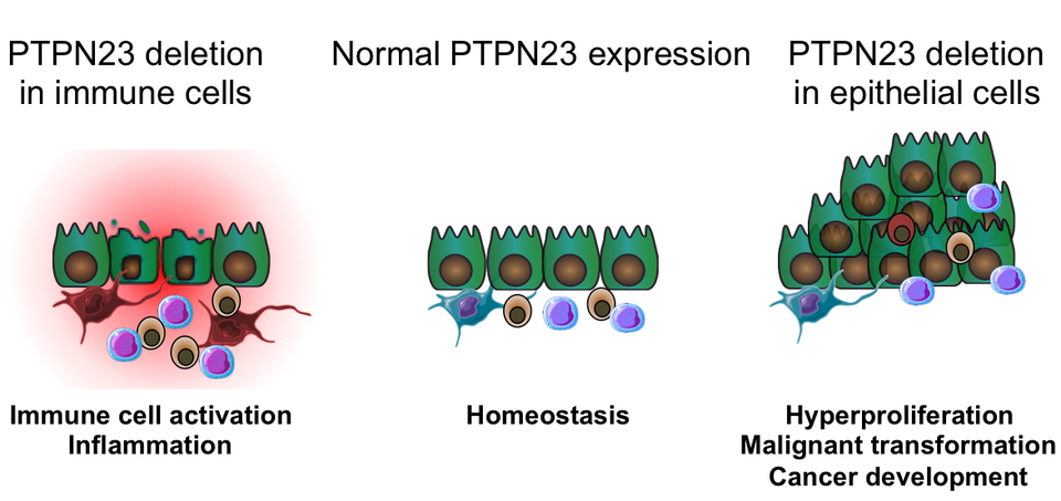 The role of PTPN23 in the development of colorectal cancer ...