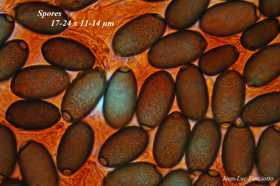 Microscopie et champignons - champignons en 3 clics
