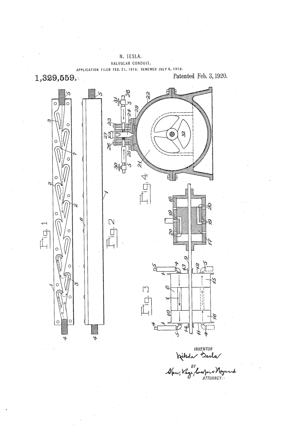 1,329,559 Valvular Conduit - Open Tesla Research