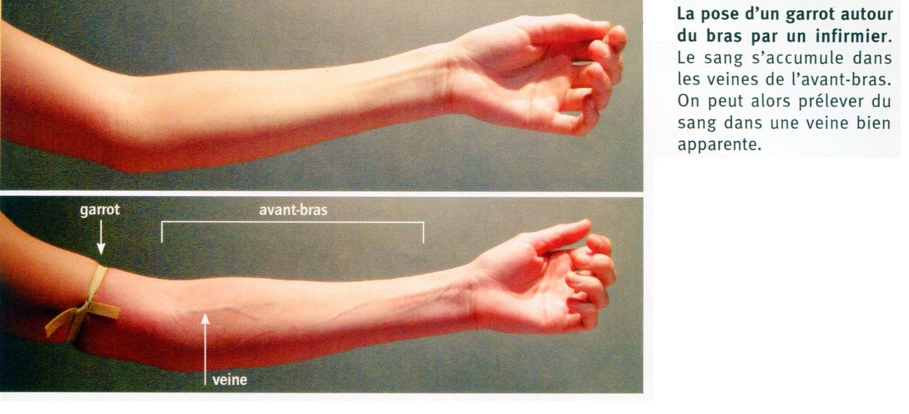 Chapitre 6: la circulation du sang - Site de cours de collège et lycée ...