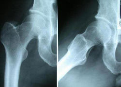 De Heup - De Heupkliniek Oudenaarde (Vlaamse Ardennen) - Dr Benoit Van ...