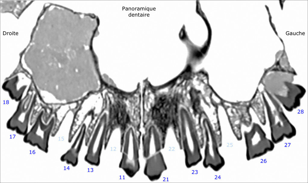 Aztec skull - Dr. Marc Ghysels, Scantix