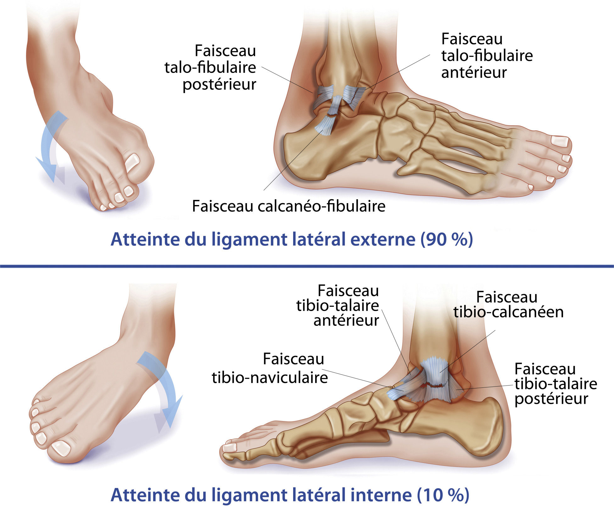 LES Entorses de la cheville - Podologue Paris 7 BATTISTINI