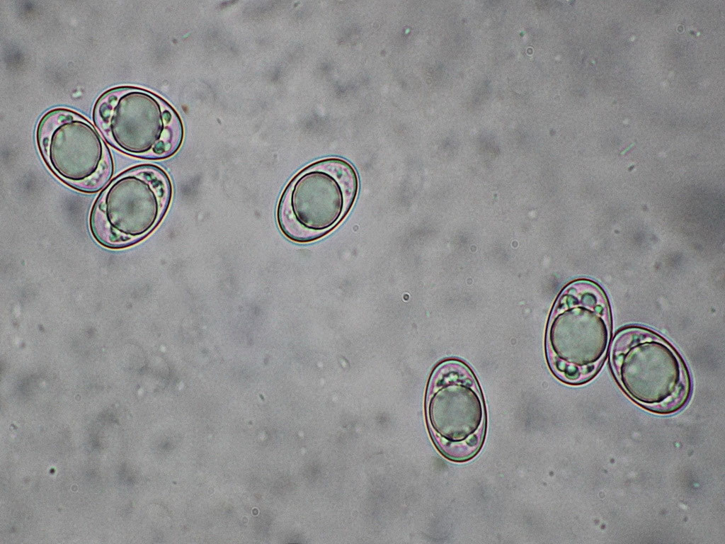 Trichophaea woolhopeia Woolhopscher Borstling - Fredis Pilzseite