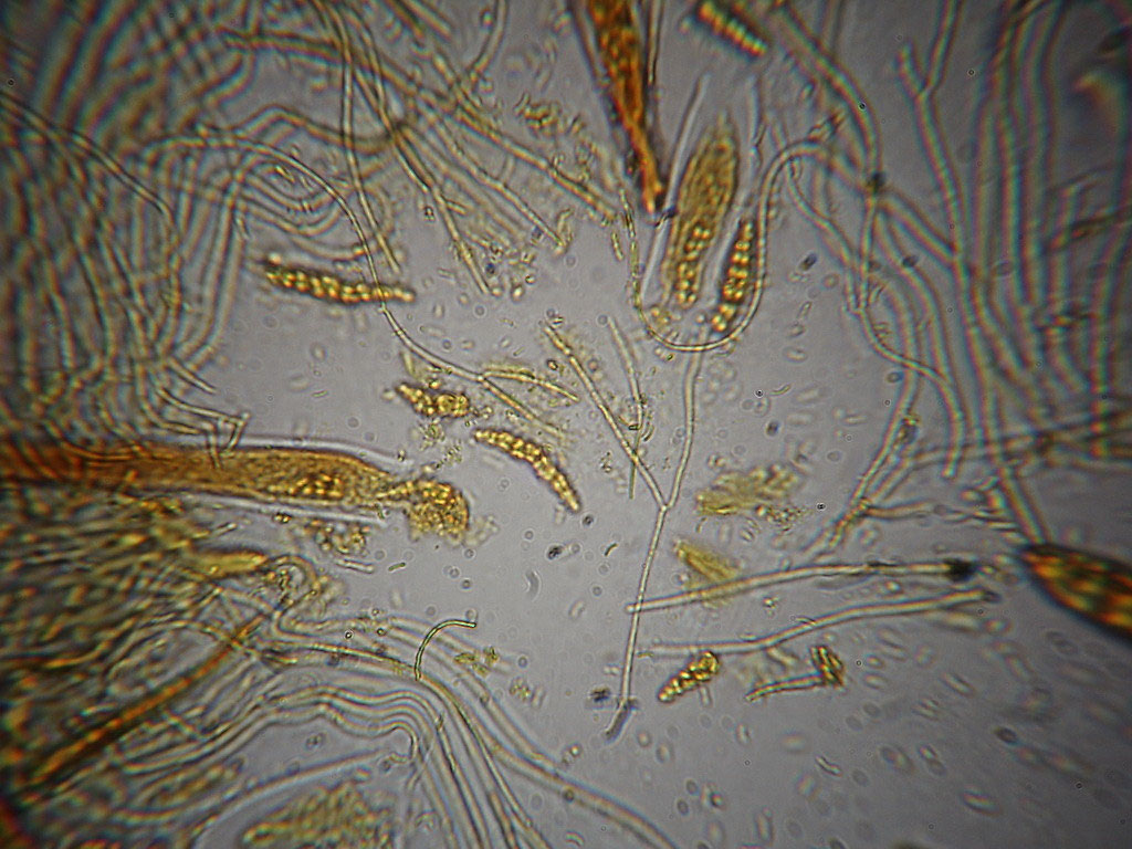 Pilzfotos-Mikromerkmale: Claussenomyces xylophilus comb. nov. Baral ...