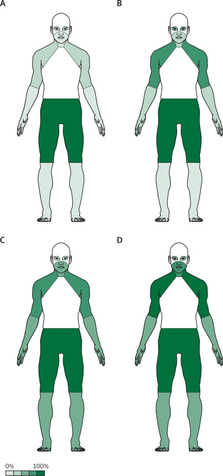 Lambert–Eaton myasthenic syndrome - NeurologyNeeds.com