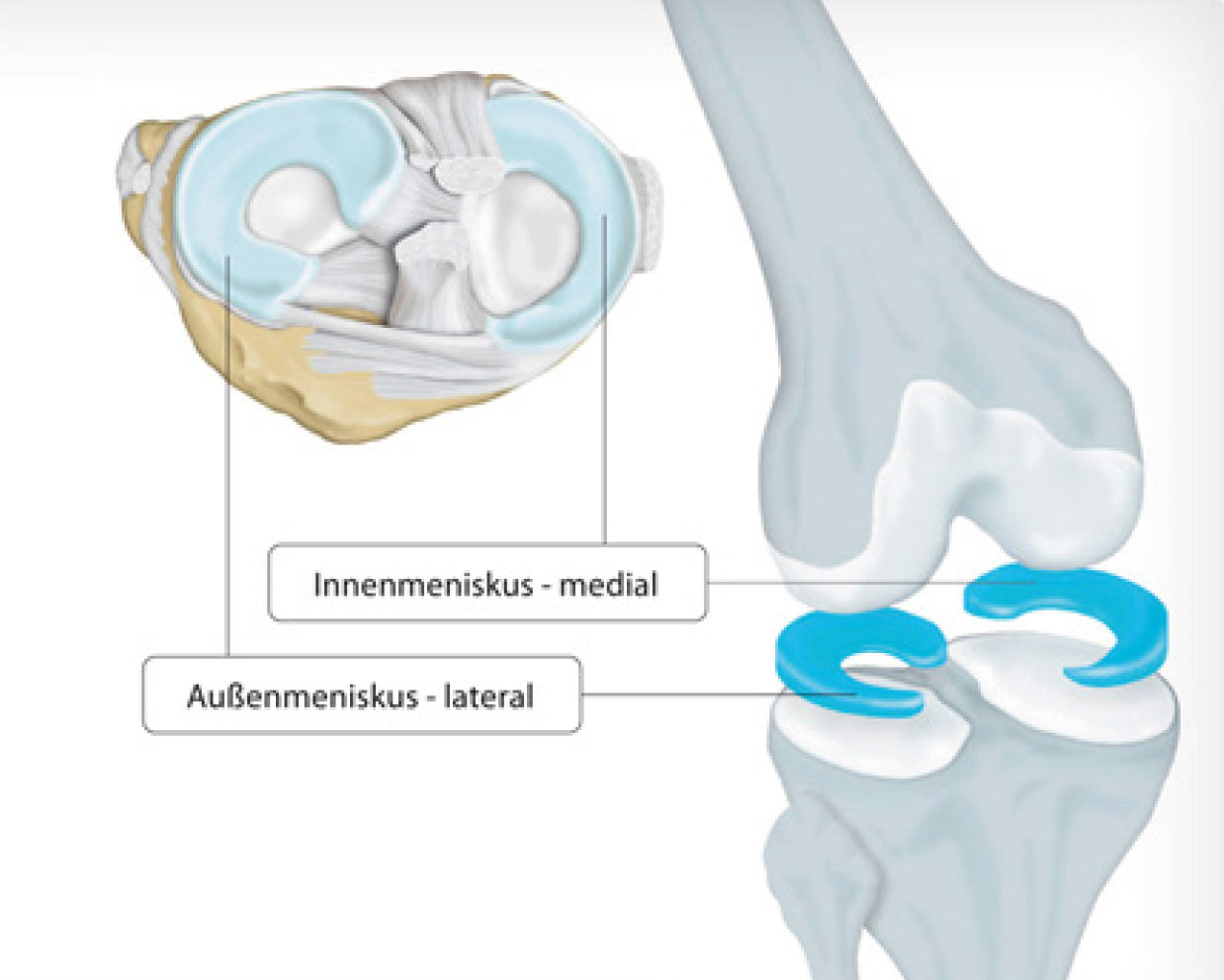 Meniskus - Orthopädische Praxis Großhansdorf