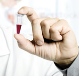 i.Mune TBNK (CE) - EPIMUNE