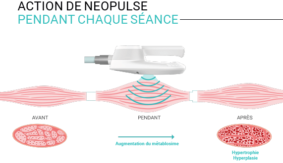 Neopulse, sculptez votre corps - Institut de beauté et bien être KerYø