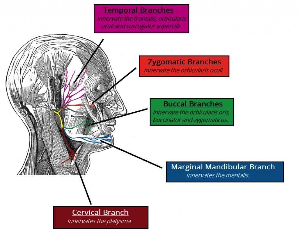 NVII Facial nerve - NeurologyNeeds.com